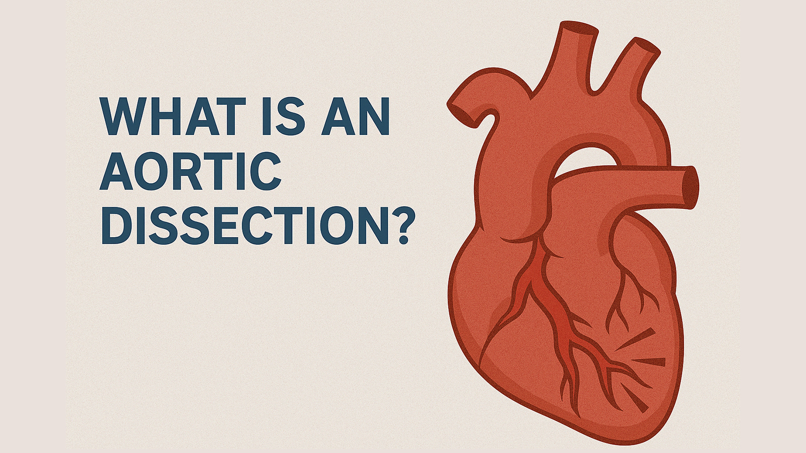 Nil Taskin | Aortic Dissection Symptoms, Causes & Treatment – Complete ...